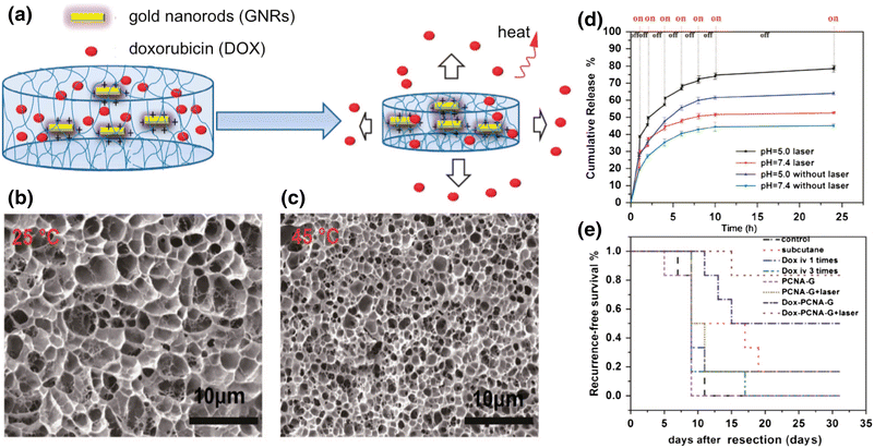 Nanoparticle-Hydrogel: A Hybrid Biomaterial System for Localized Drug ...