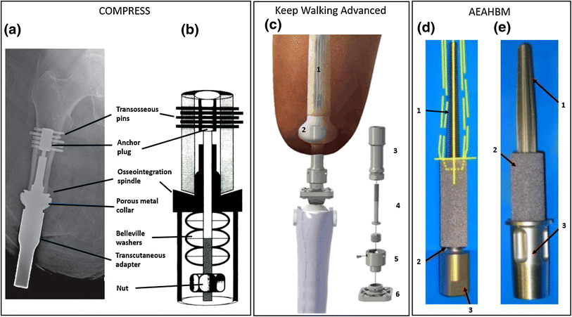 Biomechanical Characterisation of Bone-anchored Implant Systems for ...