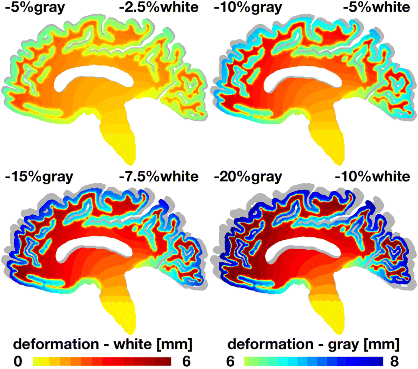 The Shrinking Brain: Cerebral Atrophy Following Traumatic Brain Injury ...