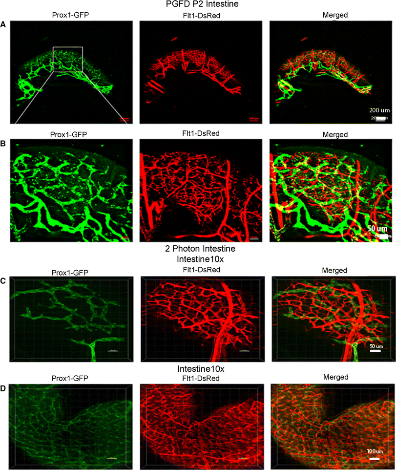 Prox1-GFP/Flt1-DsRed transgenic mice: an animal model for simultaneous ...