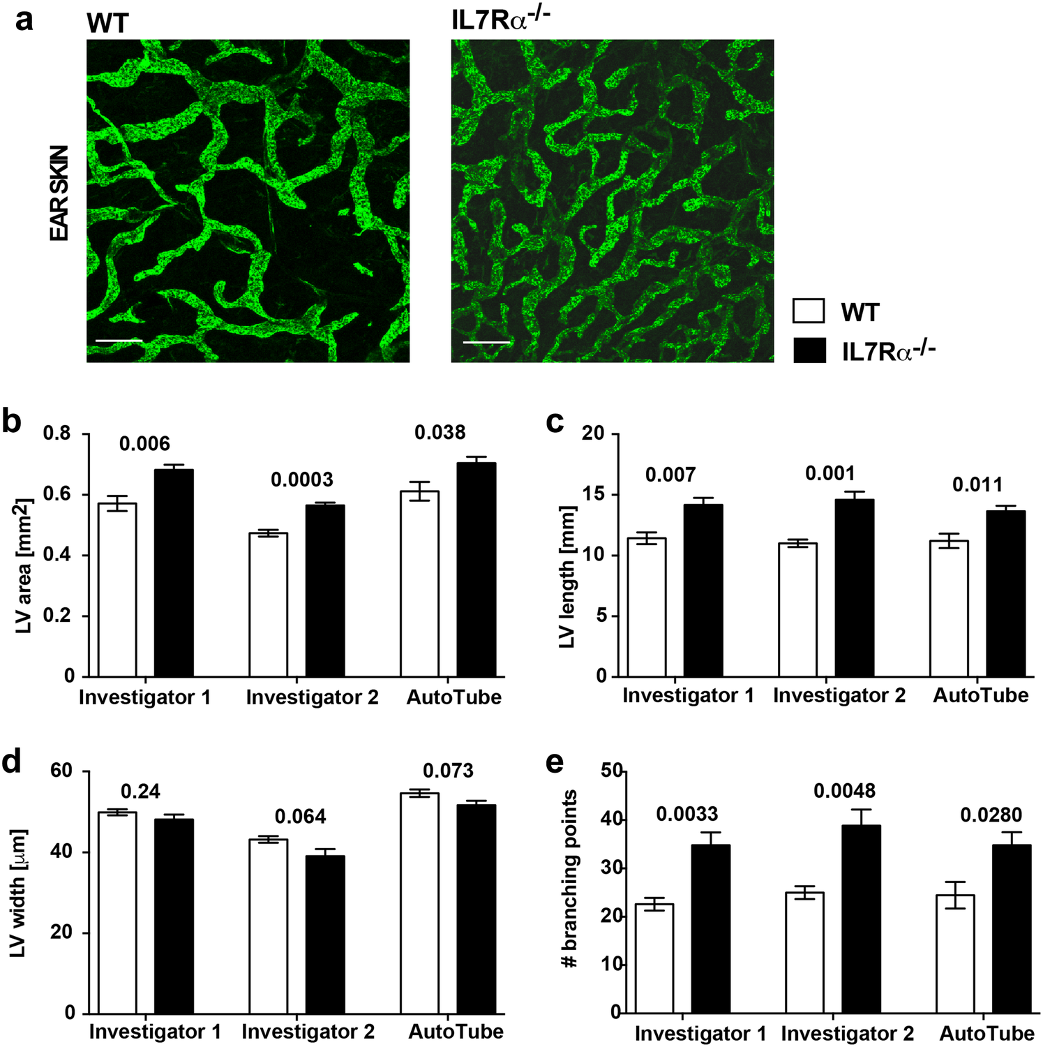 Image De Etoile Angiogenesis Analysis Imagej Tutorial 