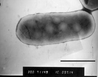 Methylobacterium soli sp. nov. a methanol -utilizing bacterium isolated ...