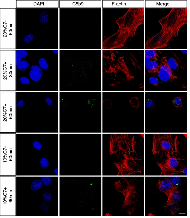 Exposure to the complement C5b-9 complex sensitizes 661W photoreceptor ...