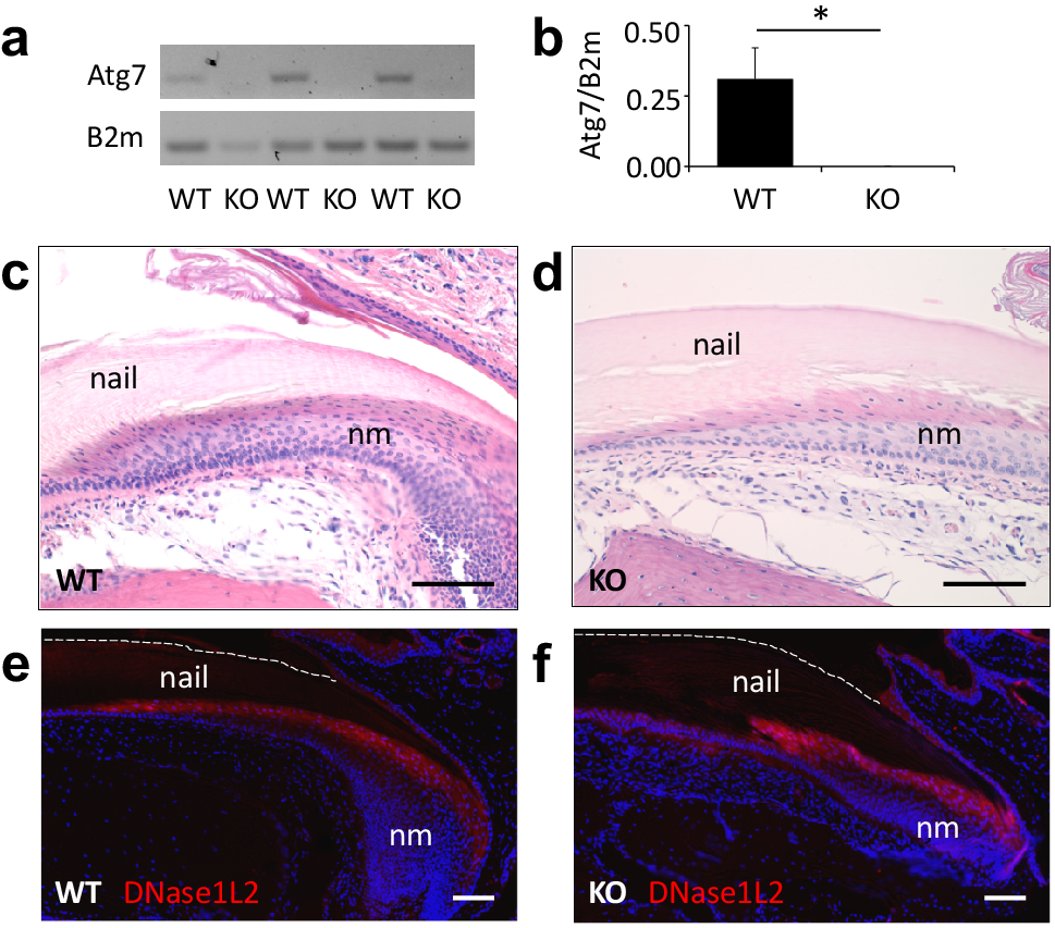 Cornification of nail keratinocytes requires autophagy for bulk ...