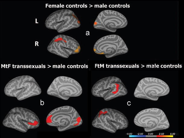 A Review of the Status of Brain Structure Research in Transsexualism ...