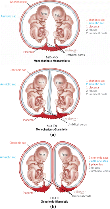 The Prenatal Environment in Twin Studies: A Review on Chorionicity ...