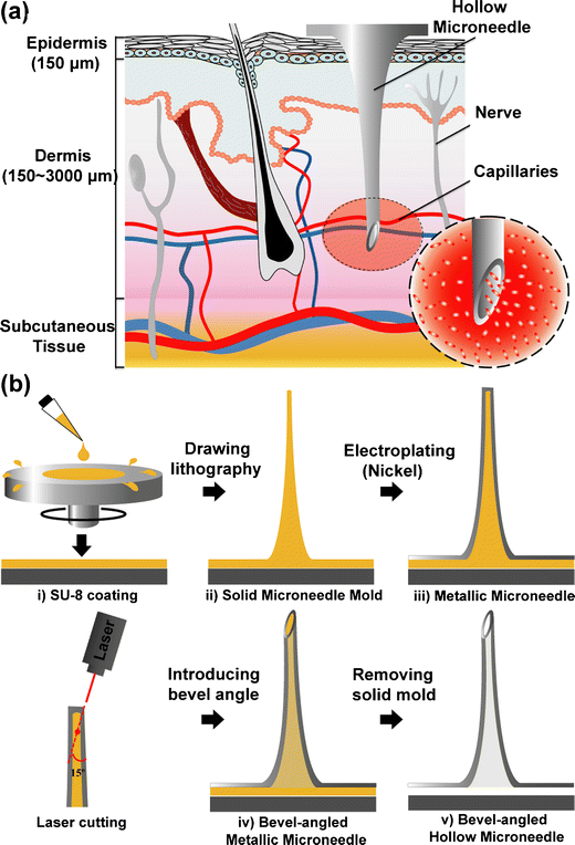 An optimized hollow microneedle for minimally invasive blood extraction ...