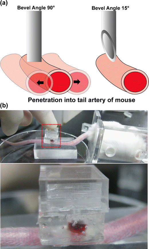 An optimized hollow microneedle for minimally invasive blood extraction ...