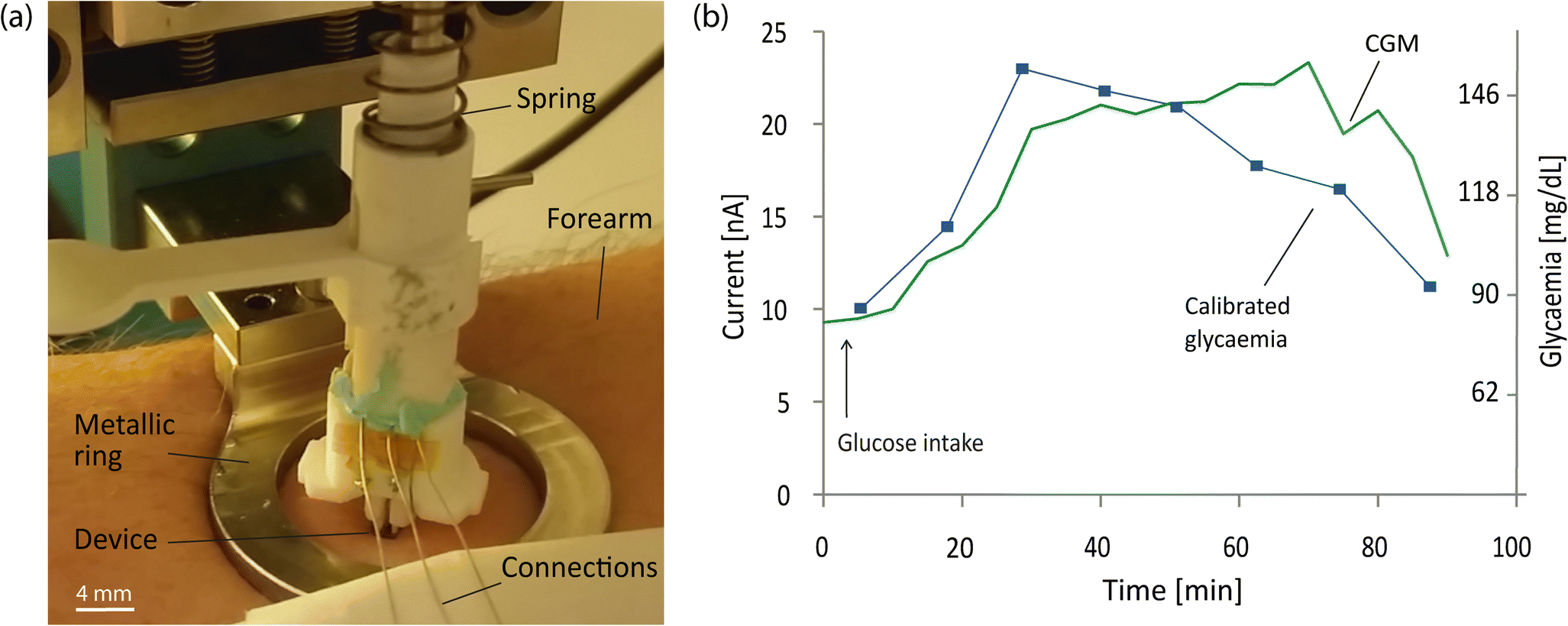 Real-time intradermal continuous glucose monitoring using a minimally ...