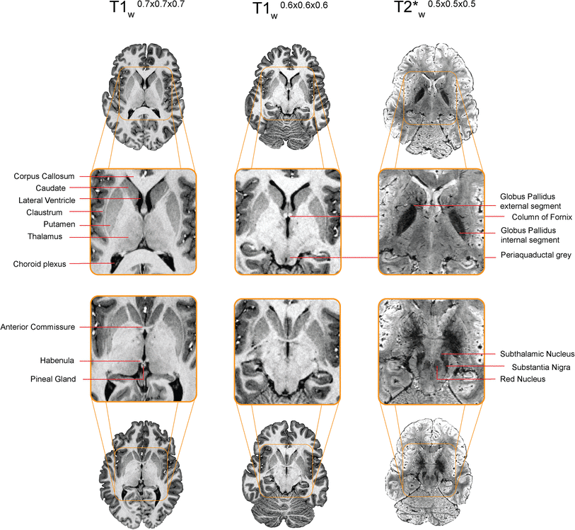 Visualizing the Human Subcortex Using Ultra-high Field Magnetic ...