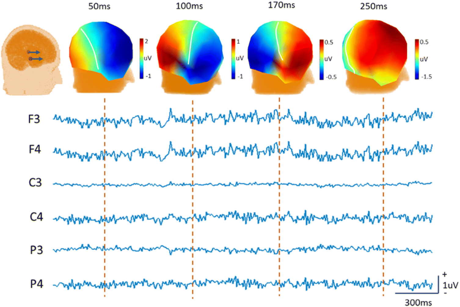 Which Reference Should We Use for EEG and ERP practice? | SpringerLink