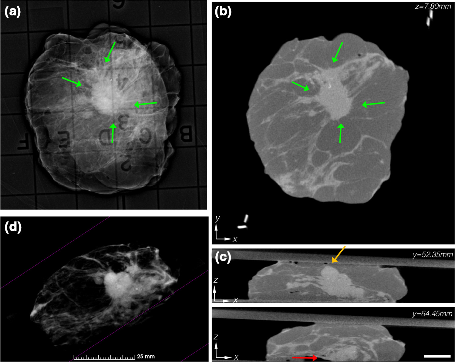 Micro-computed tomography enables rapid surgical margin assessment ...