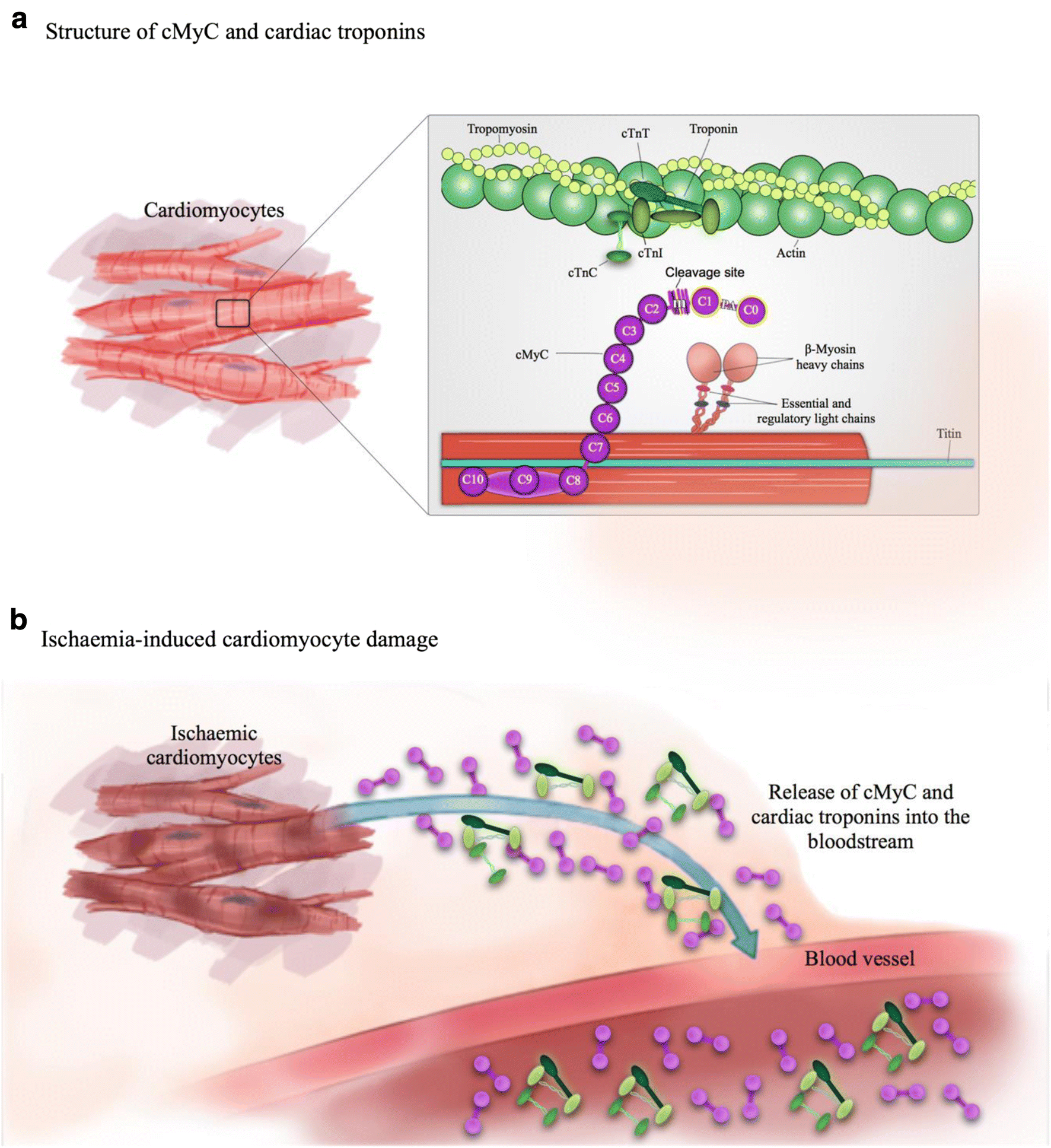 Cardiac Myosin Binding Protein C—from Bench To Improved Diagnosis Of