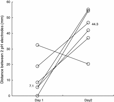 A Novel Placement Method of the Bravo Wireless pH Monitoring Capsule ...