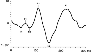 ISCEV standard for clinical visual evoked potentials (2009 update ...