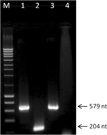 Olive mild mosaic virus transmission by Olpidium virulentus | SpringerLink