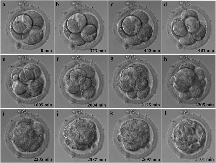 Analysis of compaction initiation in human embryos by using time-lapse ...