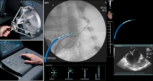 Experience of robotic catheter ablation in humans using a novel ...