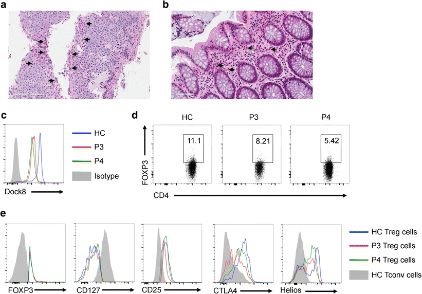 DOCK8 Deficiency Presenting as an IPEX-Like Disorder | SpringerLink