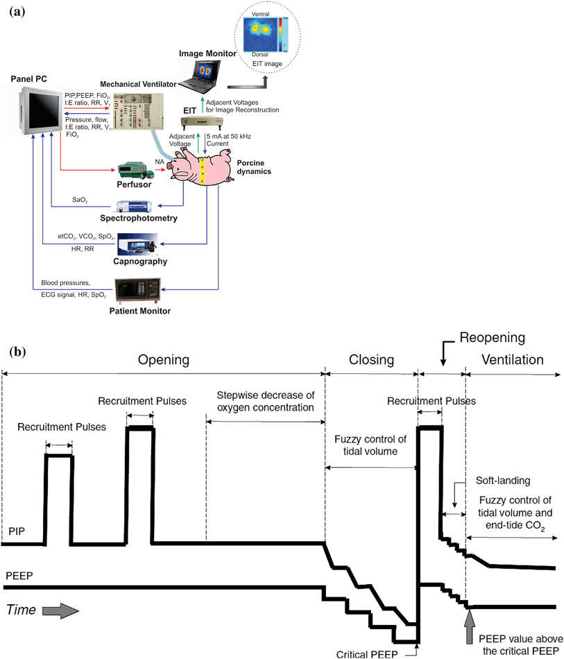 Closed-loop mechanical ventilation for lung injury: a novel ...