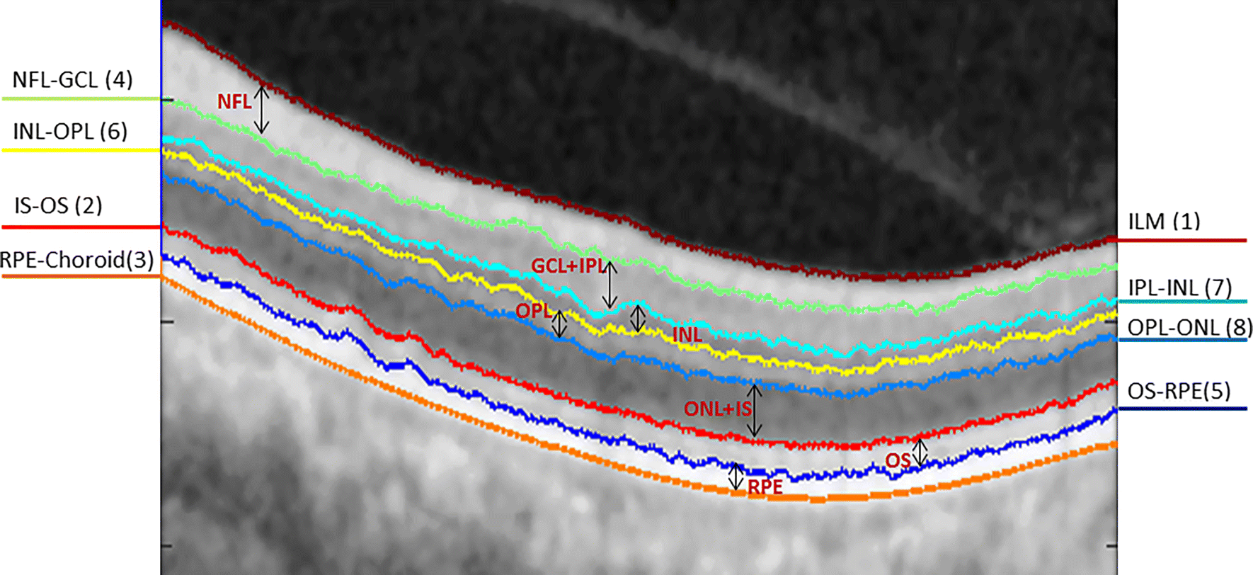 Automatic Annotation of Retinal Layers in Optical Coherence Tomography ...