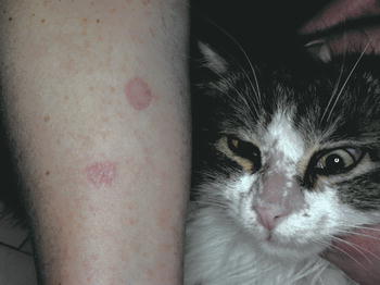 Dermatophytoses in Animals | SpringerLink