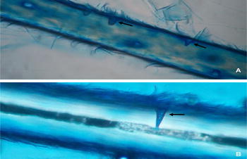 The Use of Albino Adult Hair and Blond Prepubertal Hair Yields ...