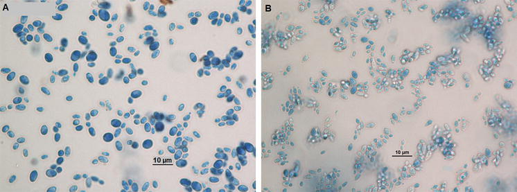 A Fatal Case of Candida auris and Candida tropicalis Candidemia in ...