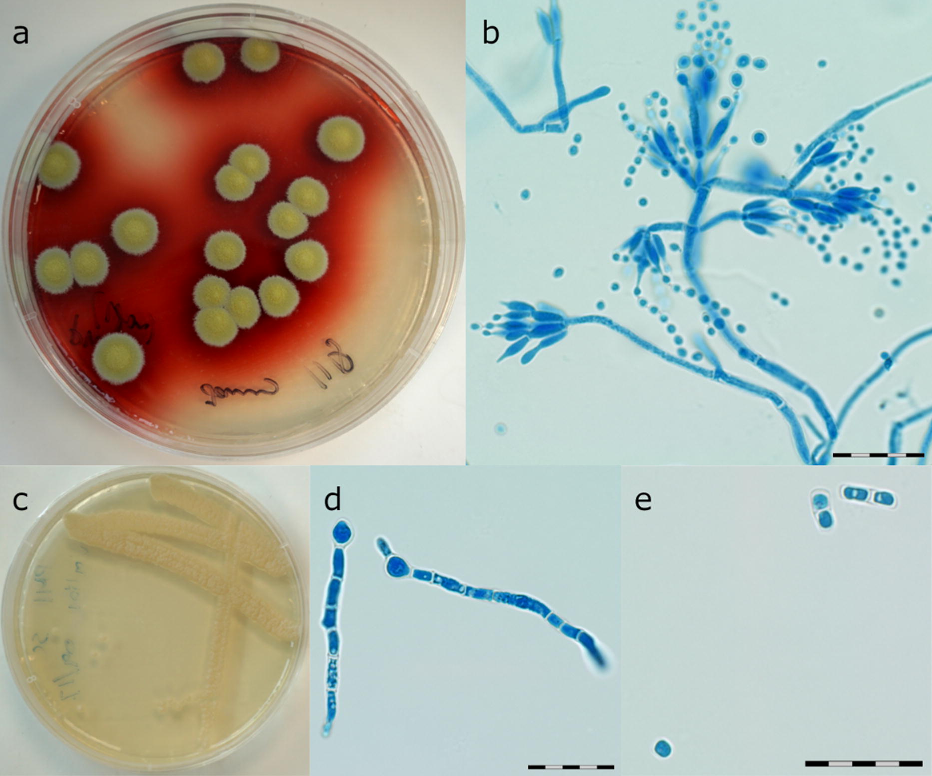 Sixty Years from Segretain’s Description: What Have We Learned and ...