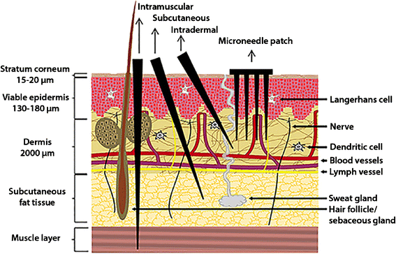 Dissolving Microneedle Patches for Dermal Vaccination | SpringerLink