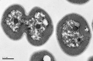 Comparative analysis of carboxysome shell proteins | SpringerLink