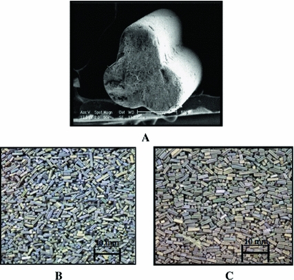 Flow Maldistribution in Dense- and Sock-Loaded Trilobe Catalyst Trickle ...