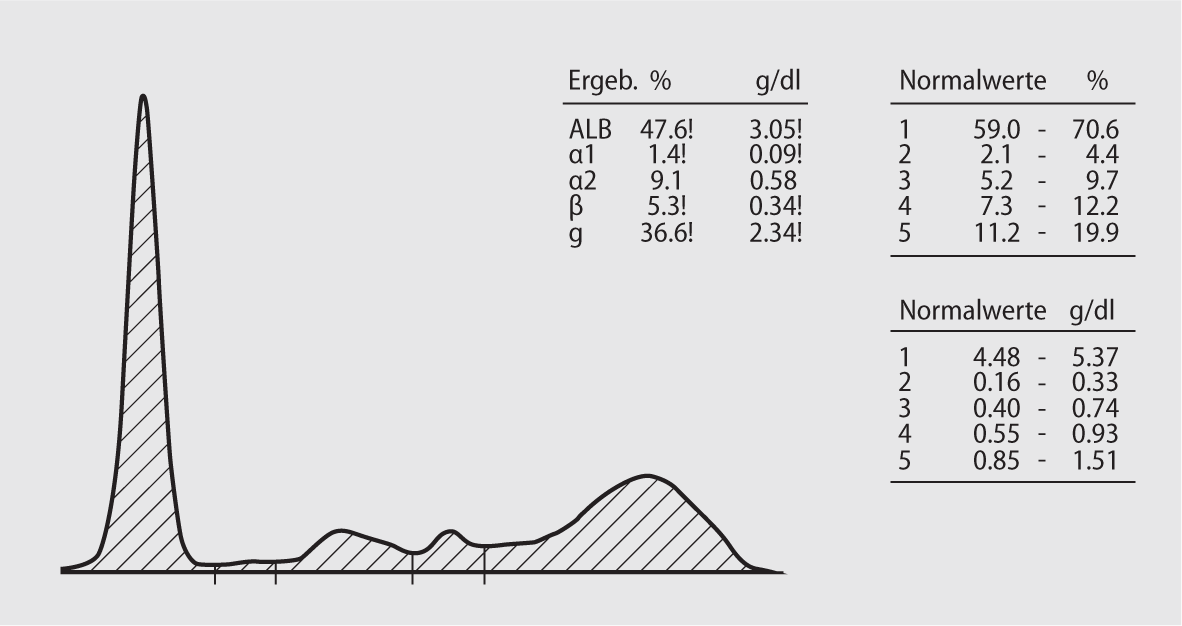 Erhöhte Leberwerte abklären | SpringerLink
