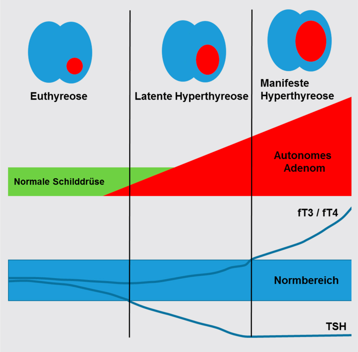 So erkennen und behandeln Sie die Hyperthyreose | SpringerLink