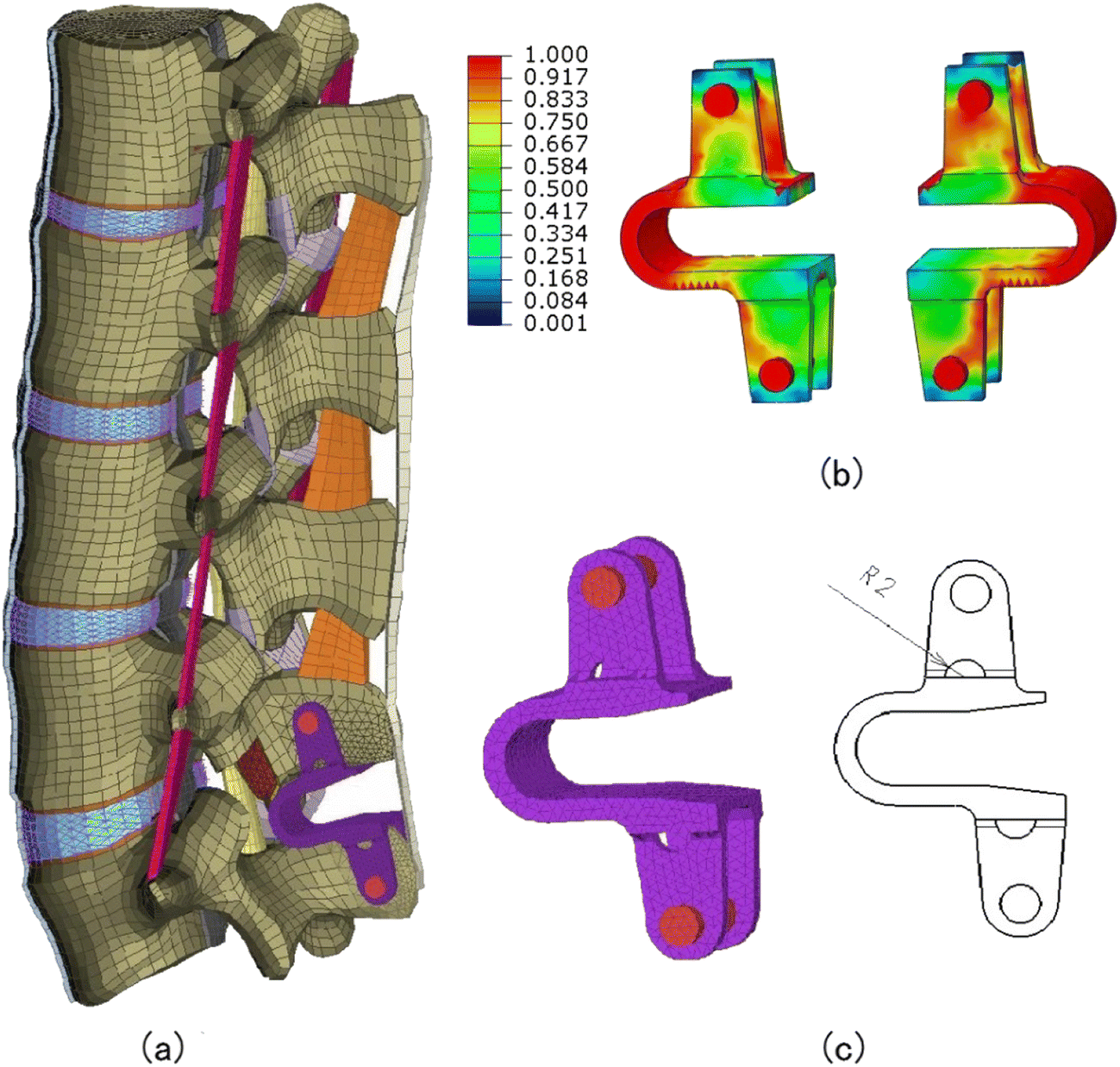 Finite element analysis and design of an interspinous device using ...