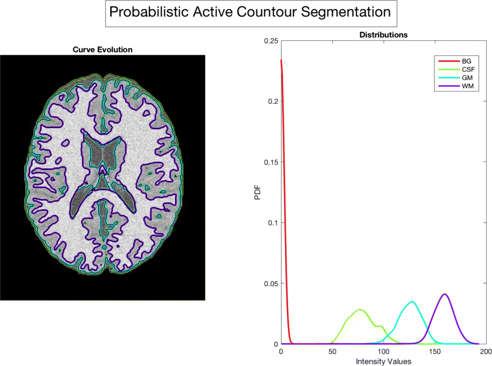 A new Probabilistic Active Contour region-based method for multiclass ...