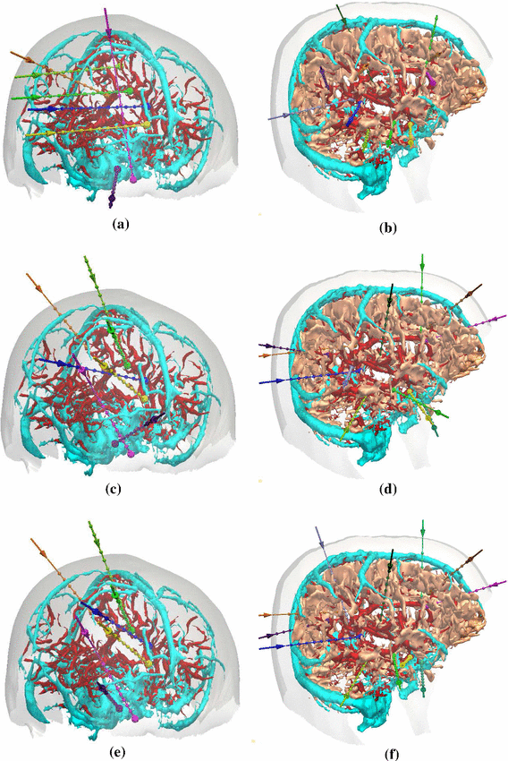 Automated multiple trajectory planning algorithm for the placement of stereo ...