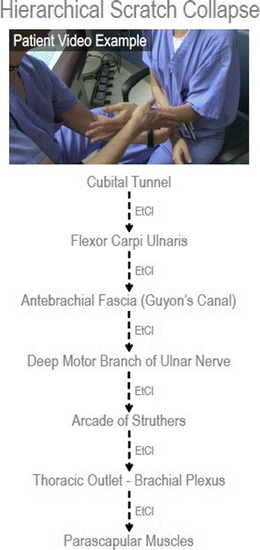 The “hierarchical” Scratch Collapse Test for identifying multilevel ...