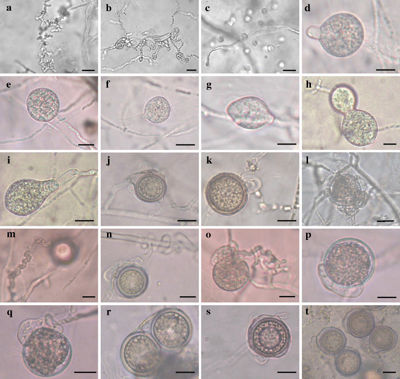 Two new Pythium species from China based on the morphology and DNA ...
