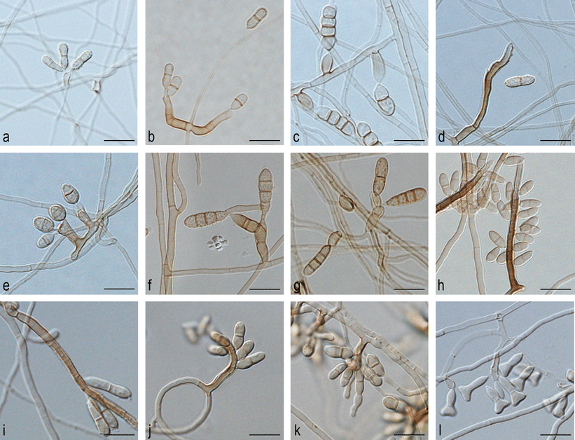 A new species of the oligotrophic genus Ochroconis (Sympoventuriaceae ...