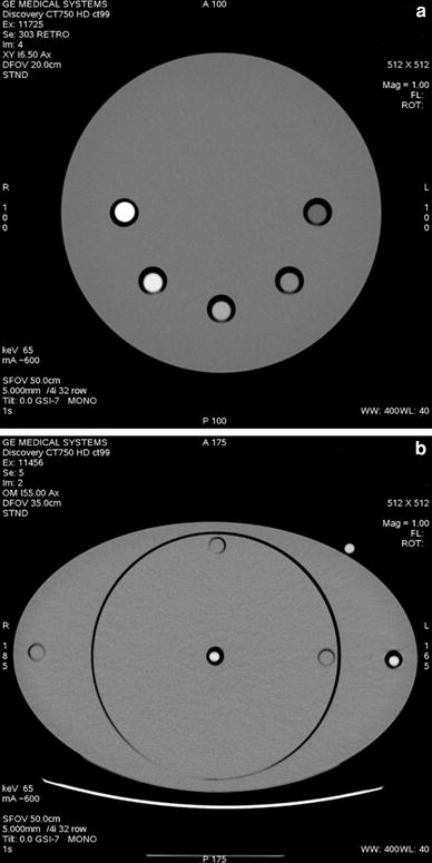 Precision of the measurement of CT numbers: comparison of dual-energy ...