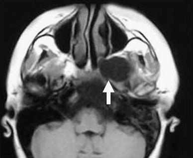 Computed tomography and magnetic resonance imaging of lesions at ...