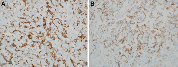 History note: tragedy of Thorotrast | SpringerLink