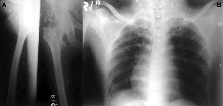 A comprehensive review of imaging findings in human cysticercosis ...