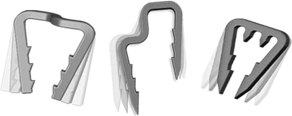 Design Considerations for Nitinol Bone Staples | SpringerLink