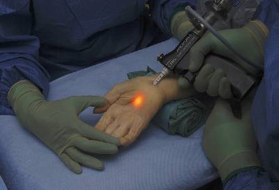 Endoskopie in der Hand- und Ellenbogenchirurgie | SpringerLink