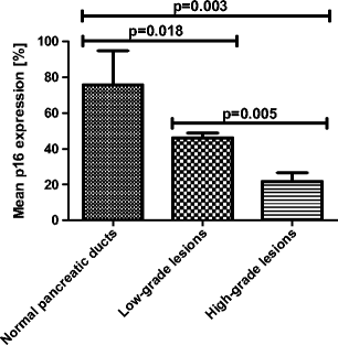 p16, p21, and p53 proteins play an important role in development of ...
