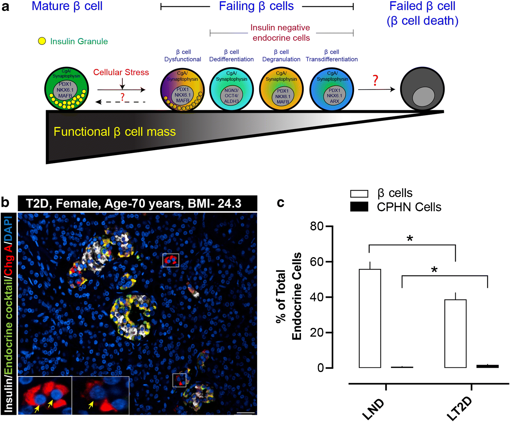 Alterations in Beta Cell Identity in Type 1 and Type 2 Diabetes ...