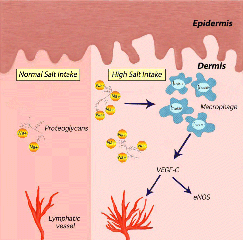 Skin Sodium and Hypertension: a Paradigm Shift? | SpringerLink