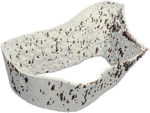 Cortical Bone Porosity: What Is It, Why Is It Important, and How Can We ...